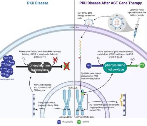 Gene Therapy for PKU: Using Viral Vectors to Treat Phenylketonuria ...